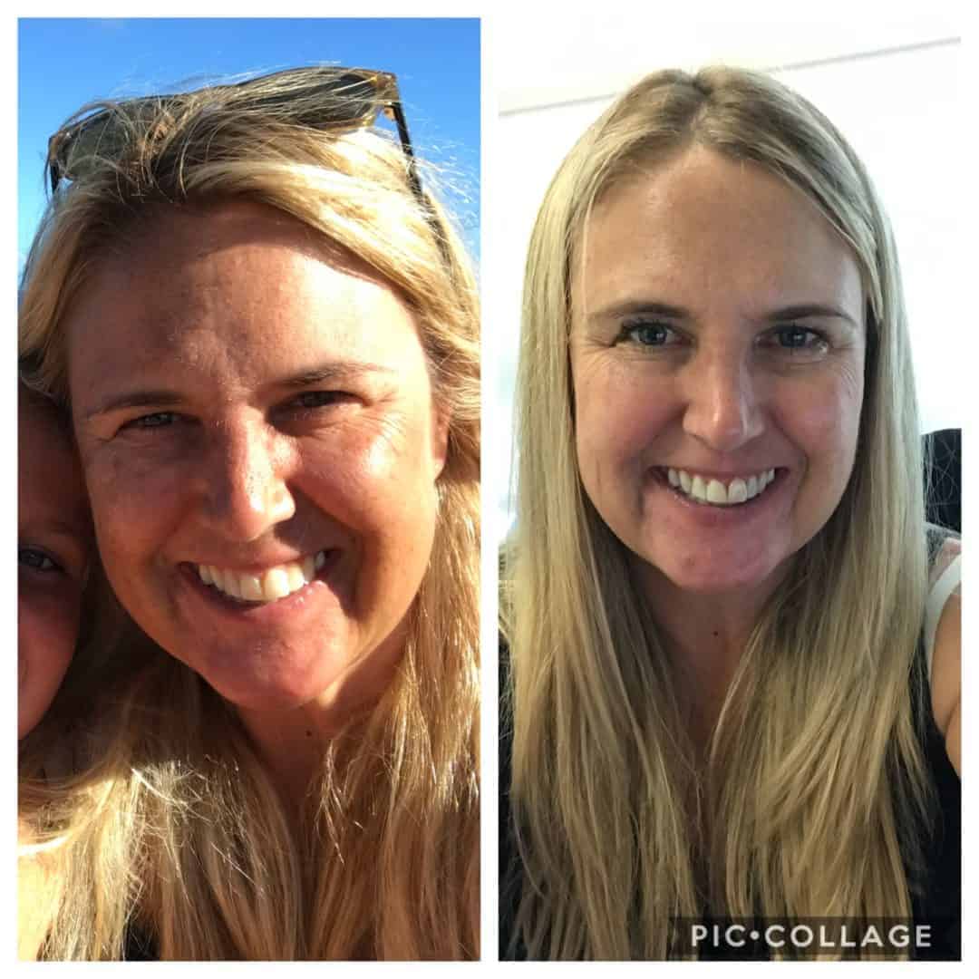 Five Easy Tips To Slim Your Face Quickly